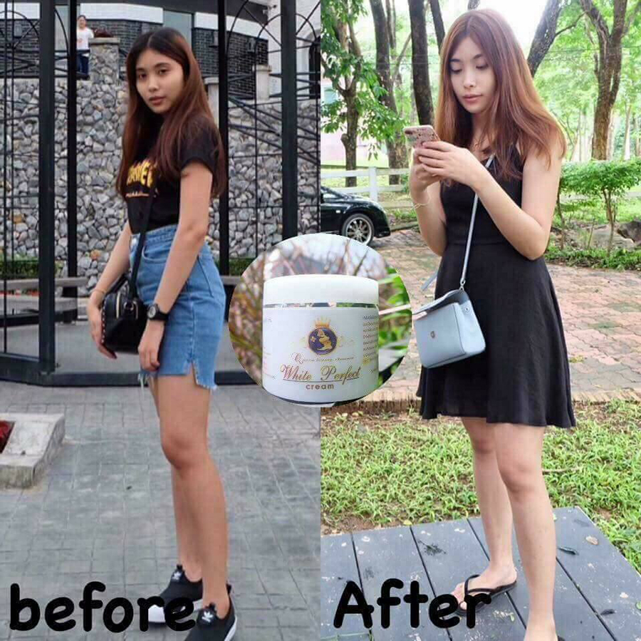 Queen White Perfect Cream - Thailand Best Selling Products - Online ...