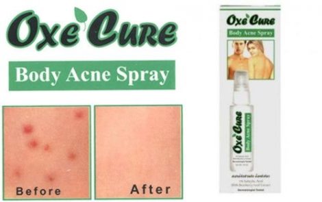 OxeCure Body Acne Spray - Thailand Best Selling Products - Online ...