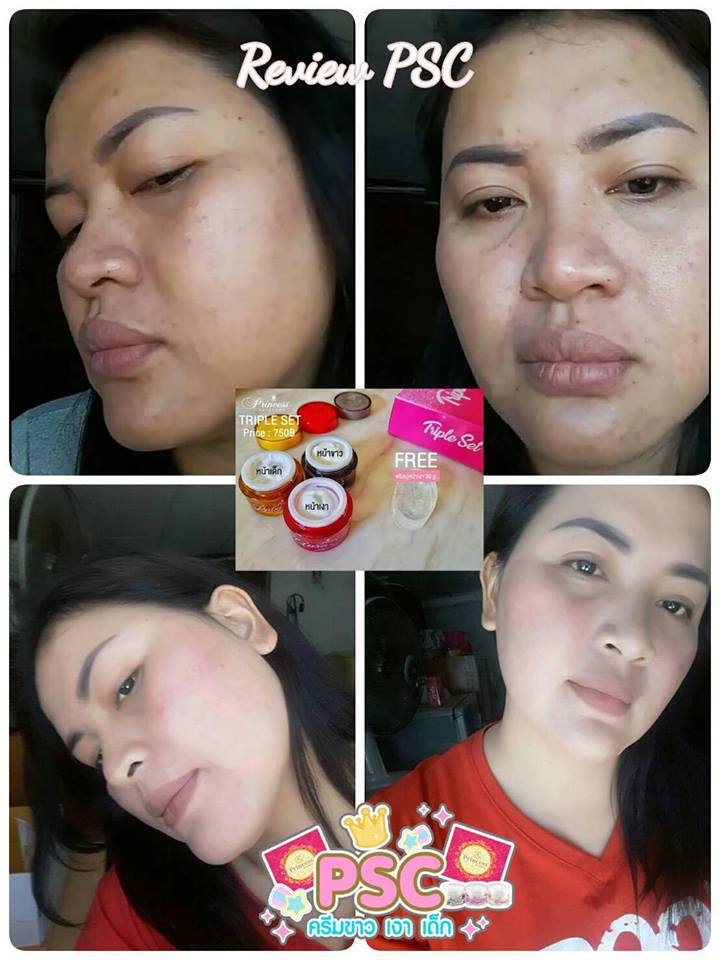 White Face Cream and Aura Face Cream by Princess White Skincare (Duo ...