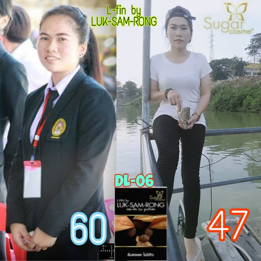 L-Fin by Luk-Sam-Rong - Thailand Best Selling Beauty Products - No.1 Online shopping Store ...