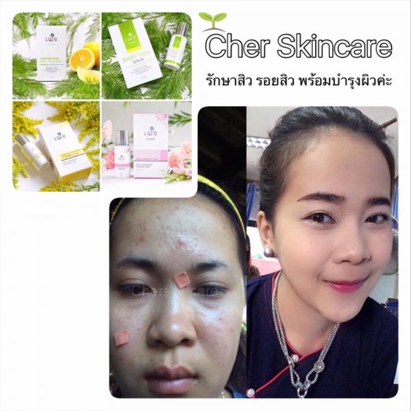 Cher Lemon Skin White + Young Serum - Thailand Best Selling Products ...