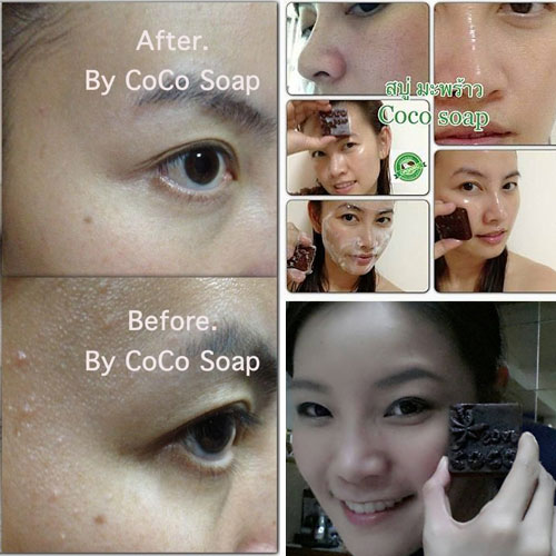 Little Baby Coco Soap – Thailand Best Selling Products – Popular Thai ...