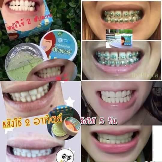 HERBAL WHITENING TOOTHPASTE by Phoca – Thailand Best Selling Products ...