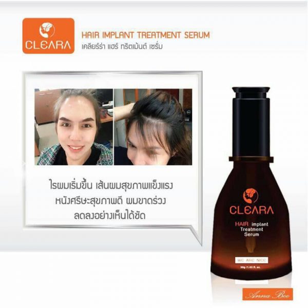 Cleara Hair Implant Treatment Serum - Thailand Best Selling Beauty Products - No.1 Online ...