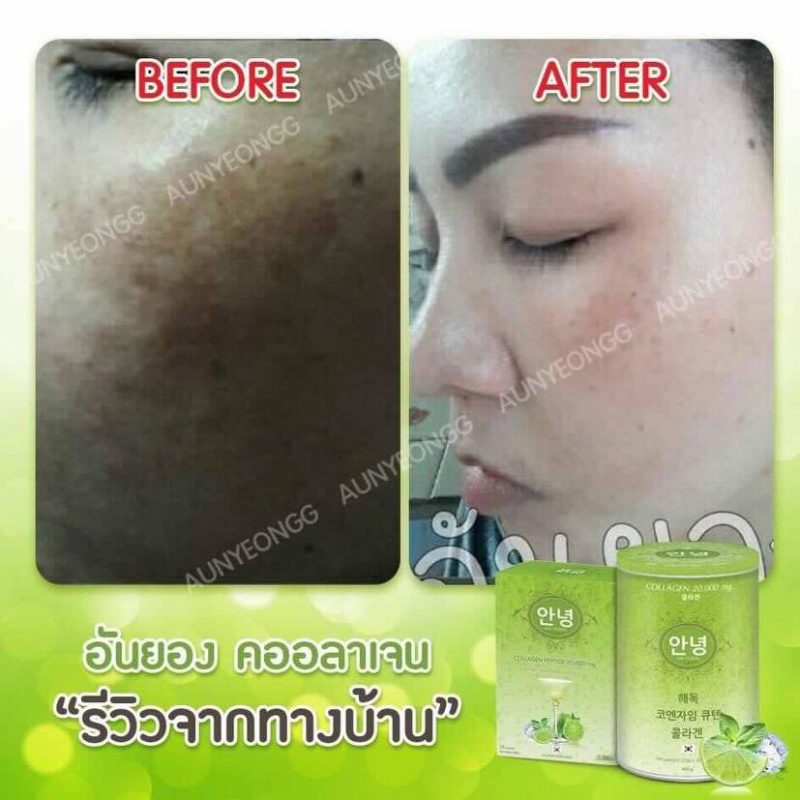 Aun-yeong Collagen 20,000 mg - Thailand Best Selling Beauty Products ...