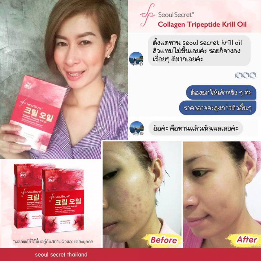 Seoul Secret Collagen Tripeptide Krill Oil - Thailand Best Selling ...