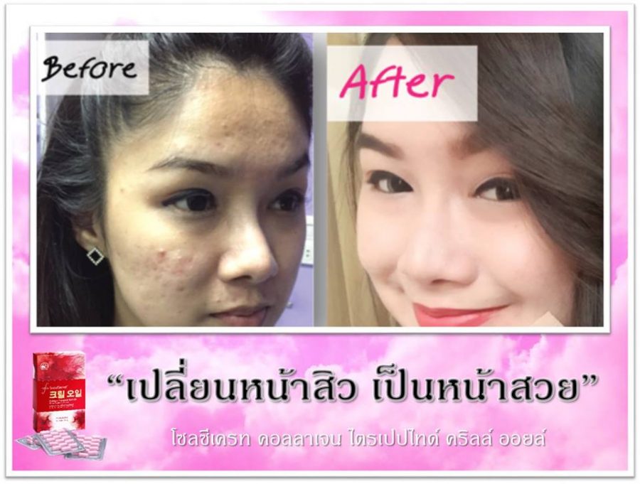 Seoul Secret Collagen Tripeptide Krill Oil - Thailand Best Selling ...