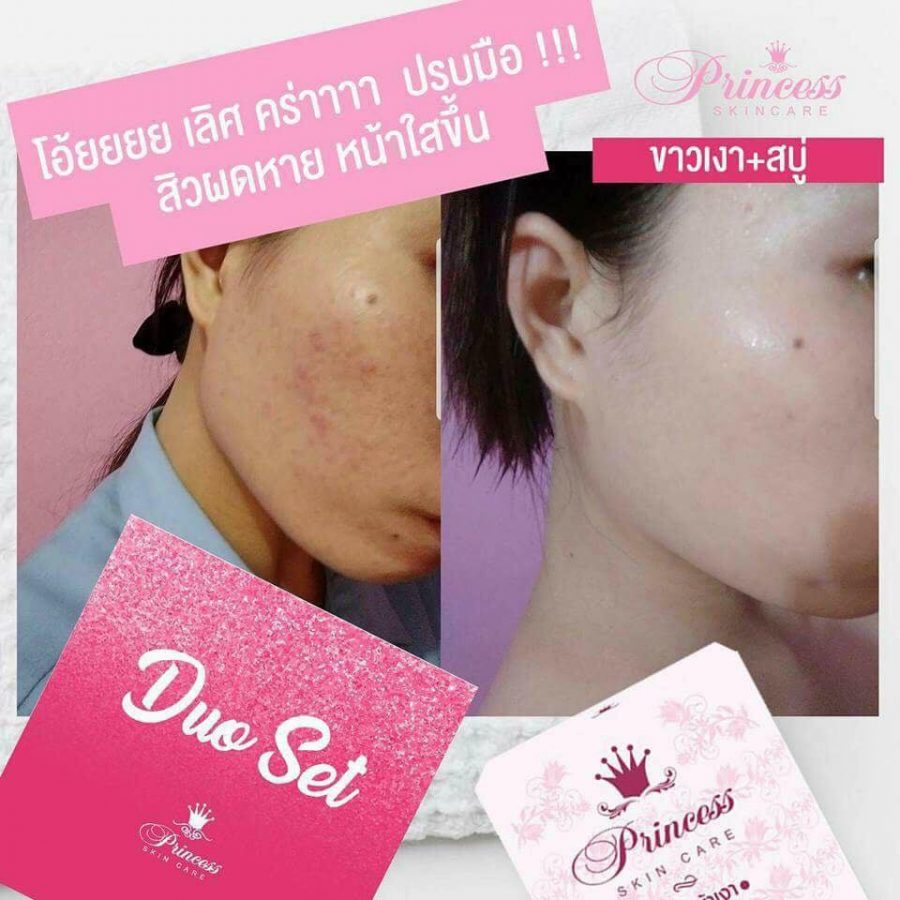 White Face Cream and Aura Face Cream by Princess White Skincare (Duo ...