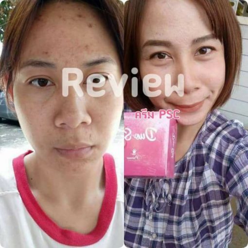 White Face Cream and Aura Face Cream by Princess White Skincare (Duo ...