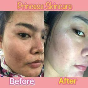White Face Cream and Aura Face Cream by Princess White Skincare (Duo ...
