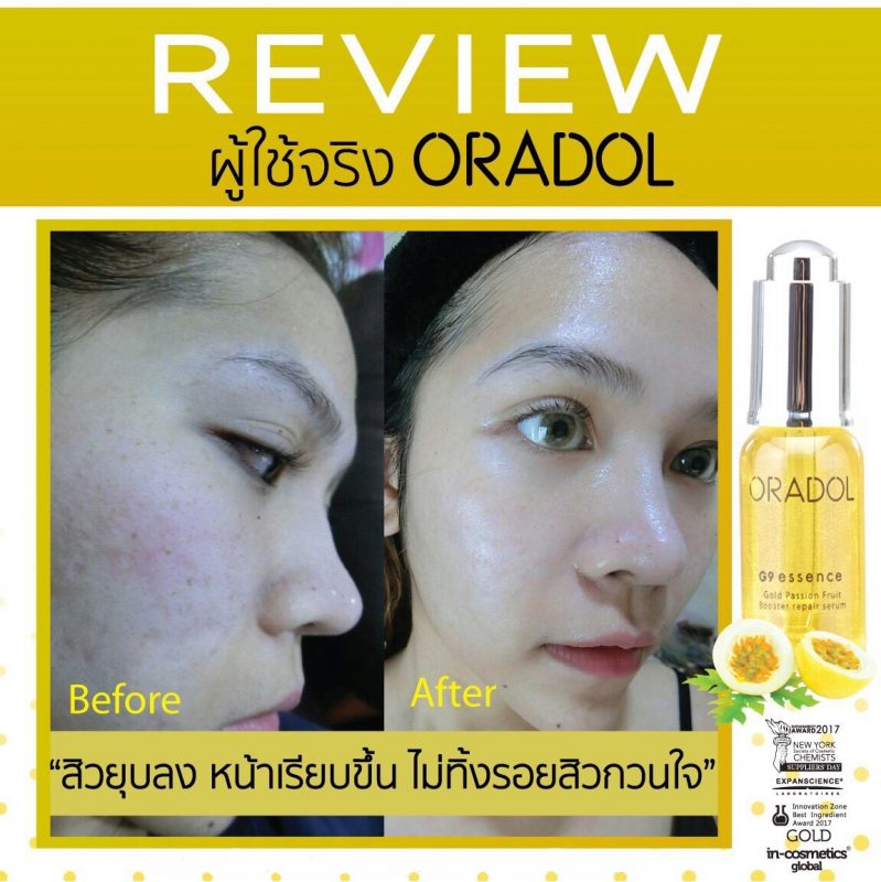 Oradol G9 Essence Serum – Thailand Best Selling Products – Popular Thai ...