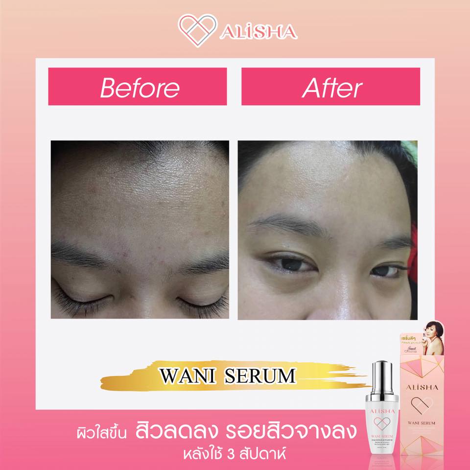 Alisha Wani Serum Dna Repair Activator - Thailand Best Selling Beauty ...