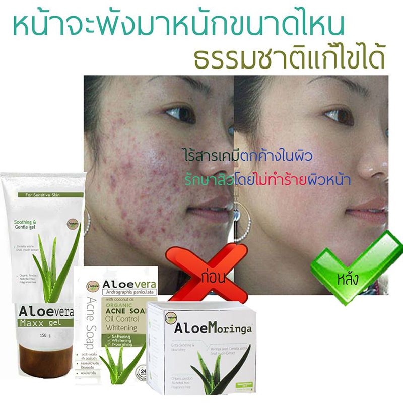 i nature Aloe Moringa Detox Gel - Thailand Best Selling Beauty Products ...
