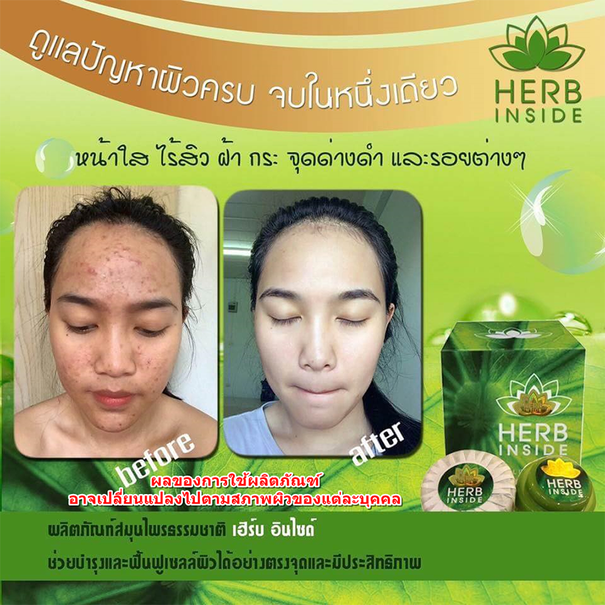 Herb Inside Soap - Thailand Best Selling Beauty Products - No.1 Online ...