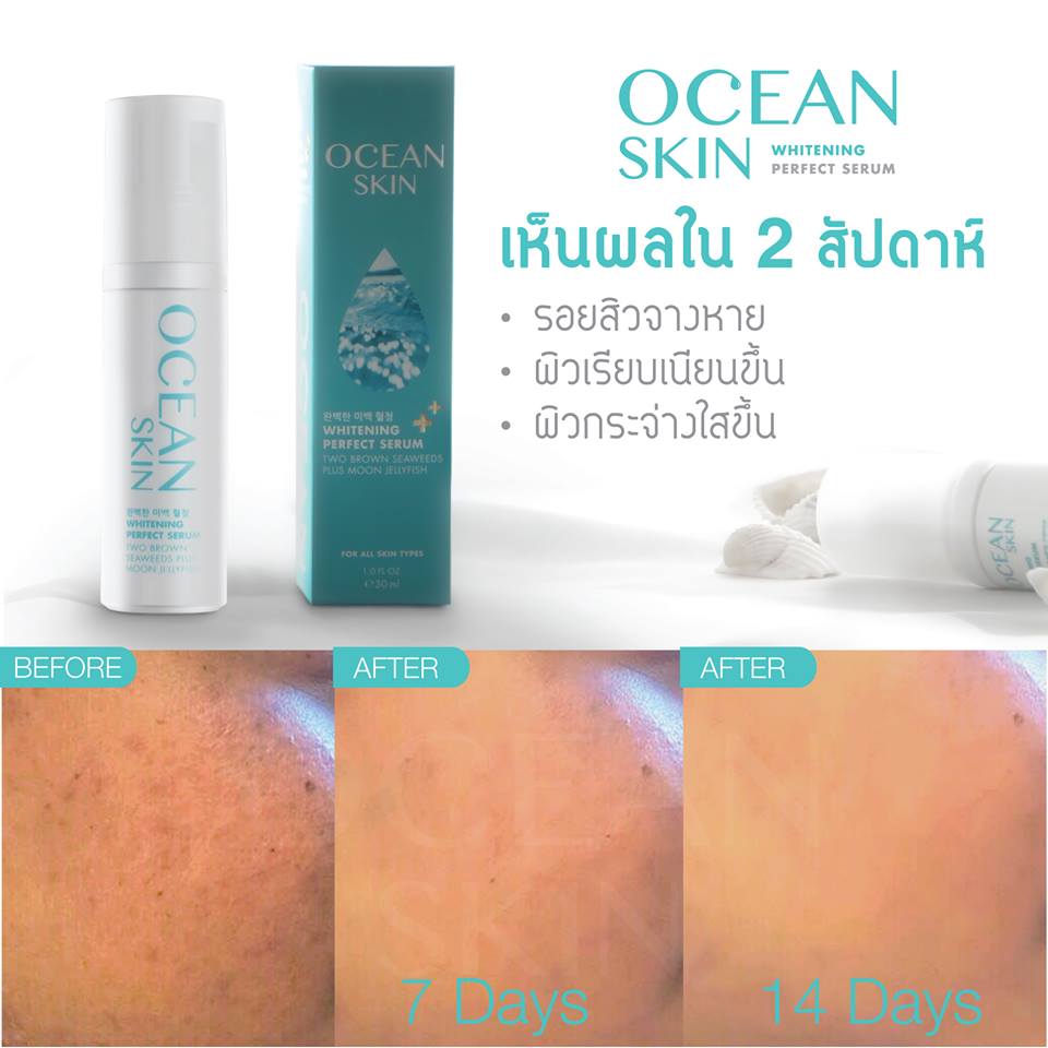 Ocean Skin Whitening Perfect Serum - Thailand Best Selling Beauty ...