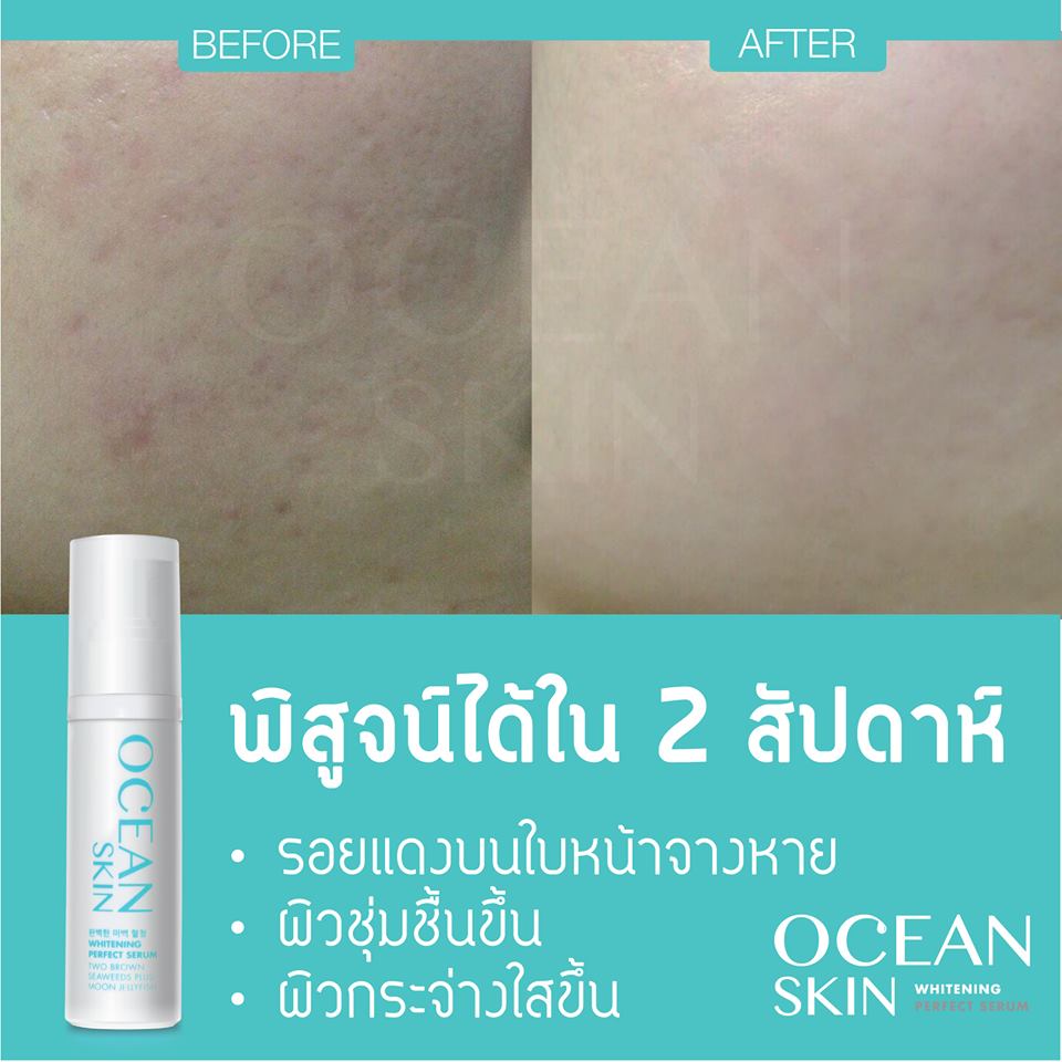 Ocean Skin Whitening Perfect Serum - Thailand Best Selling Beauty ...