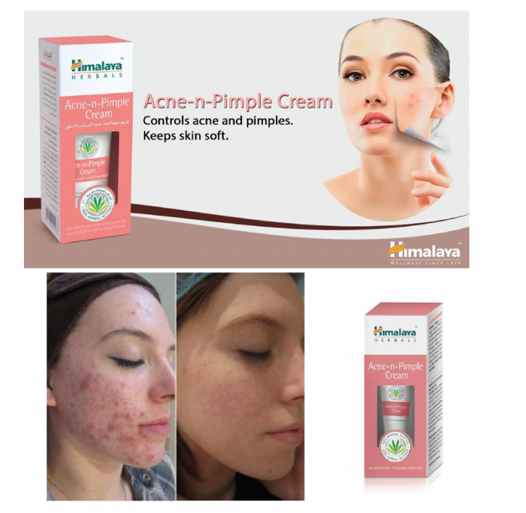 Himalaya Herbals Acne-n-Pimple Cream - Thailand Best Selling Products ...