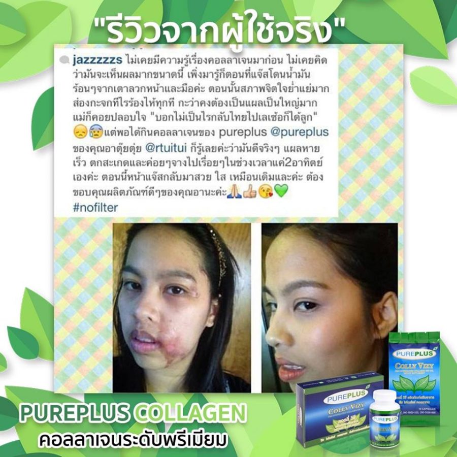 Pure Plus Colly Vizy Fish Hydrolyzed Premium Collagen - Thailand Best ...