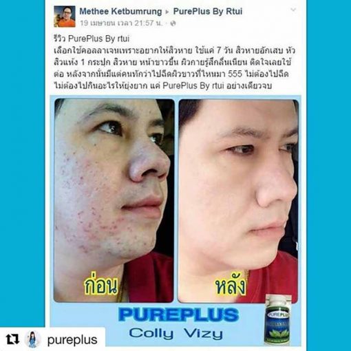 Pure Plus Colly Vizy Fish Hydrolyzed Premium Collagen - Thailand Best ...