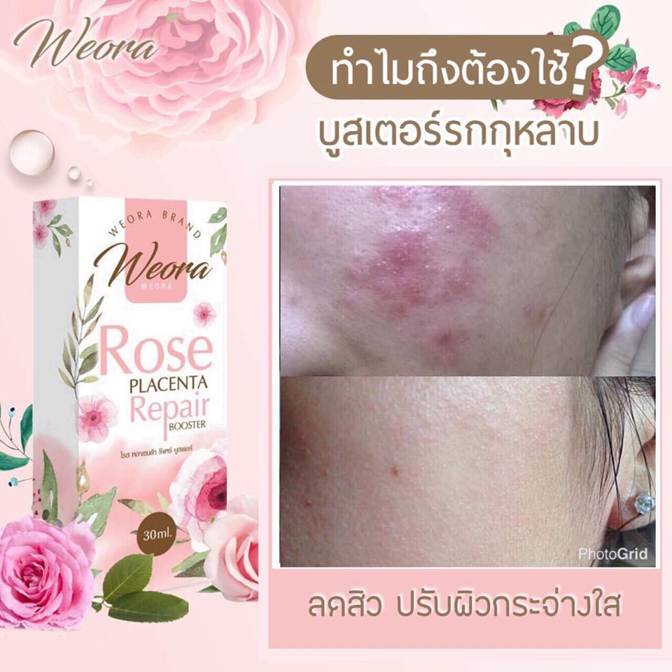 Weora Rose Placenta Repair Booster - Thailand Best Selling Beauty ...
