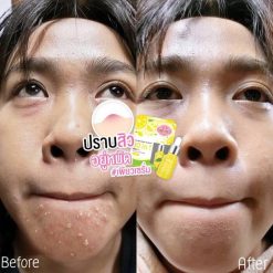 Pure Face Power Up Serum 10 in 1 by Jellys - Thailand Best Selling ...