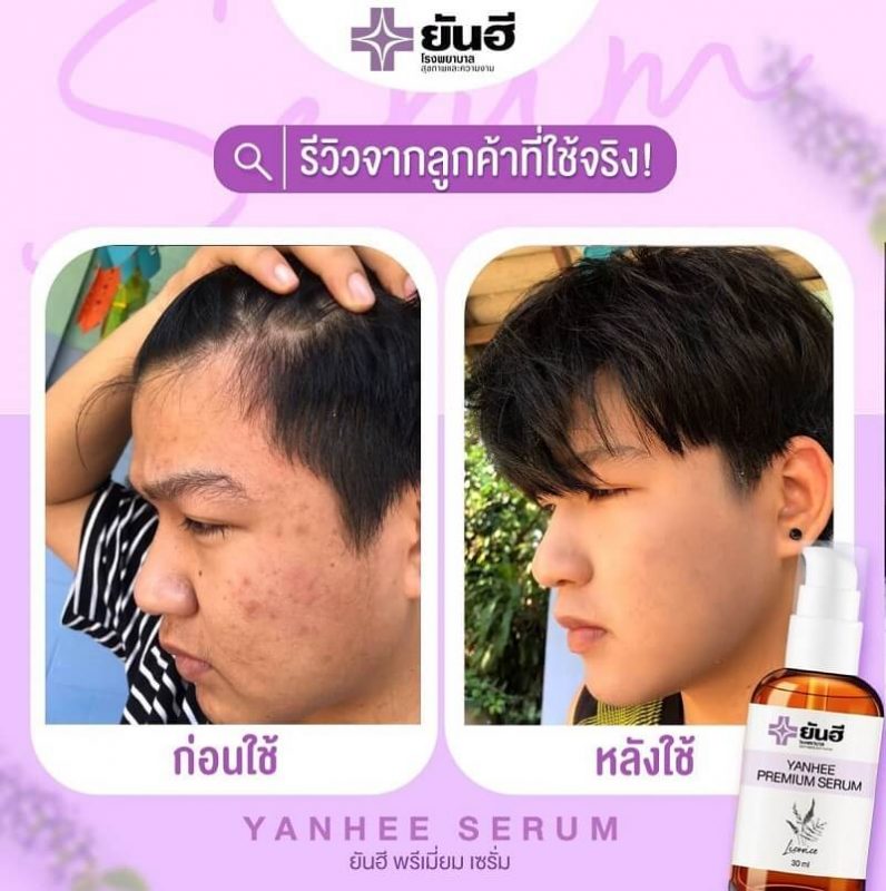 Yanhee Premium Serum - Thailand Best Selling Beauty Products - No.1 ...
