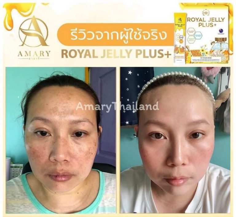 Amary Royal Jelly Plus - Thailand Best Selling Beauty Products - No.1 ...