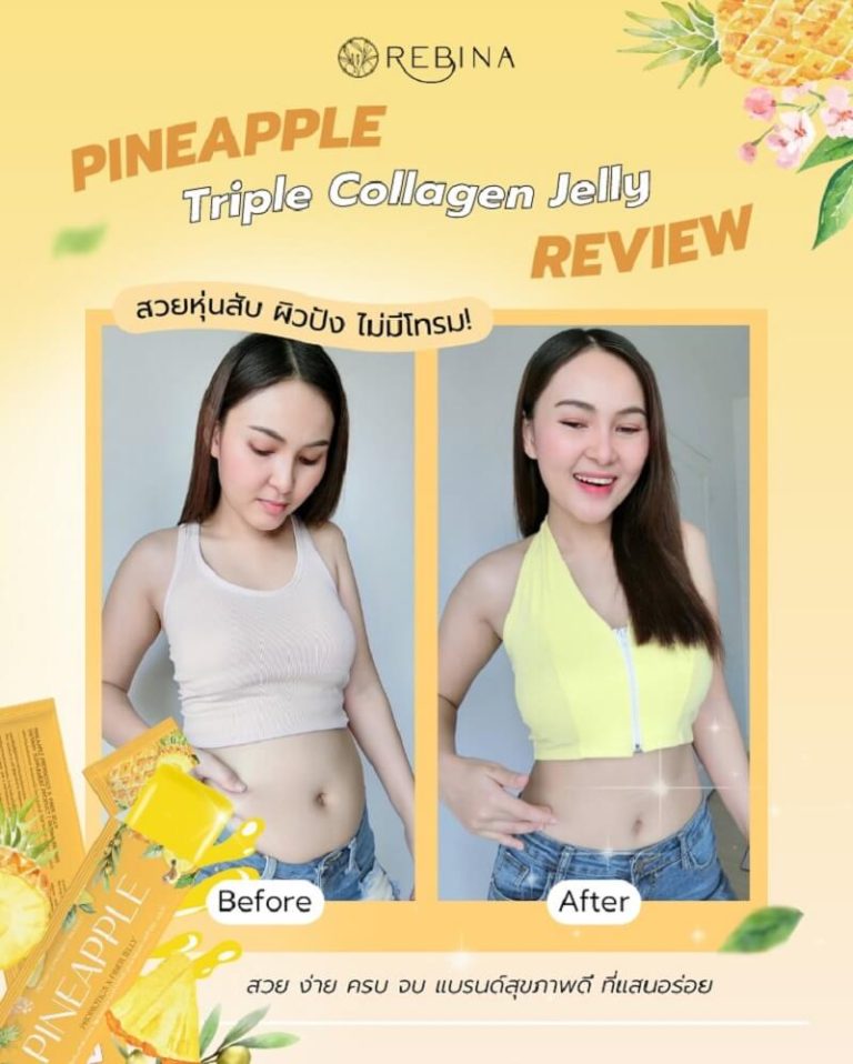 Rebina Pineapple Probiotics X Fiber Jelly - Thailand Best Selling ...